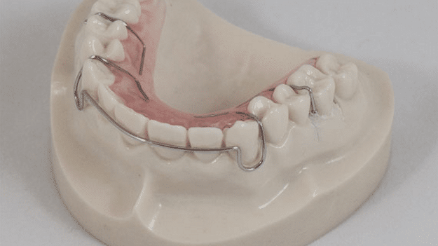 Life After Braces: Plastic and Wire Retainers | Orthodontic Associates