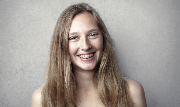 Common Braces Problems and How to Solve Them | Orthodontic Associates